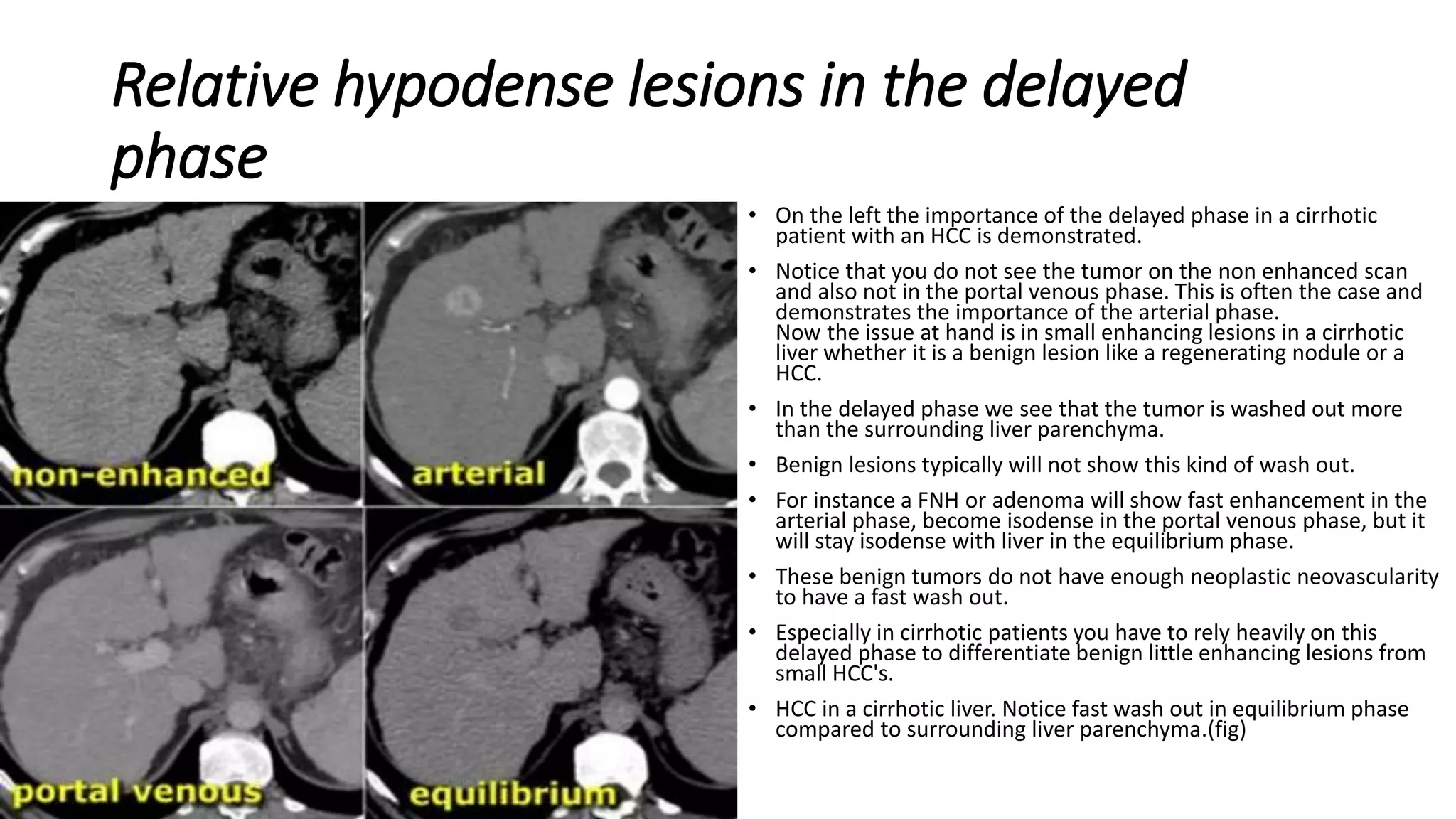 Triphasic CT scan | PPTX