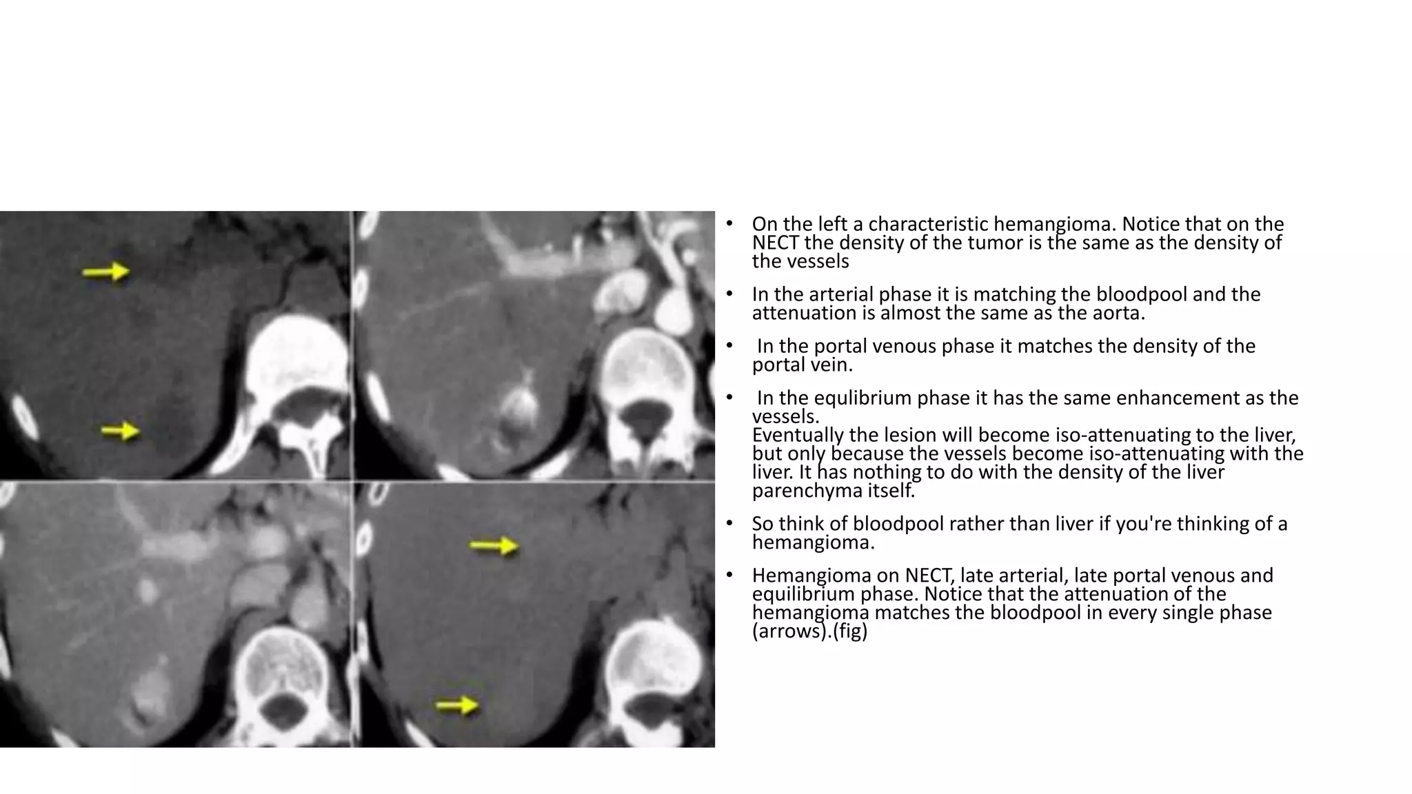 Triphasic CT scan | PPTX