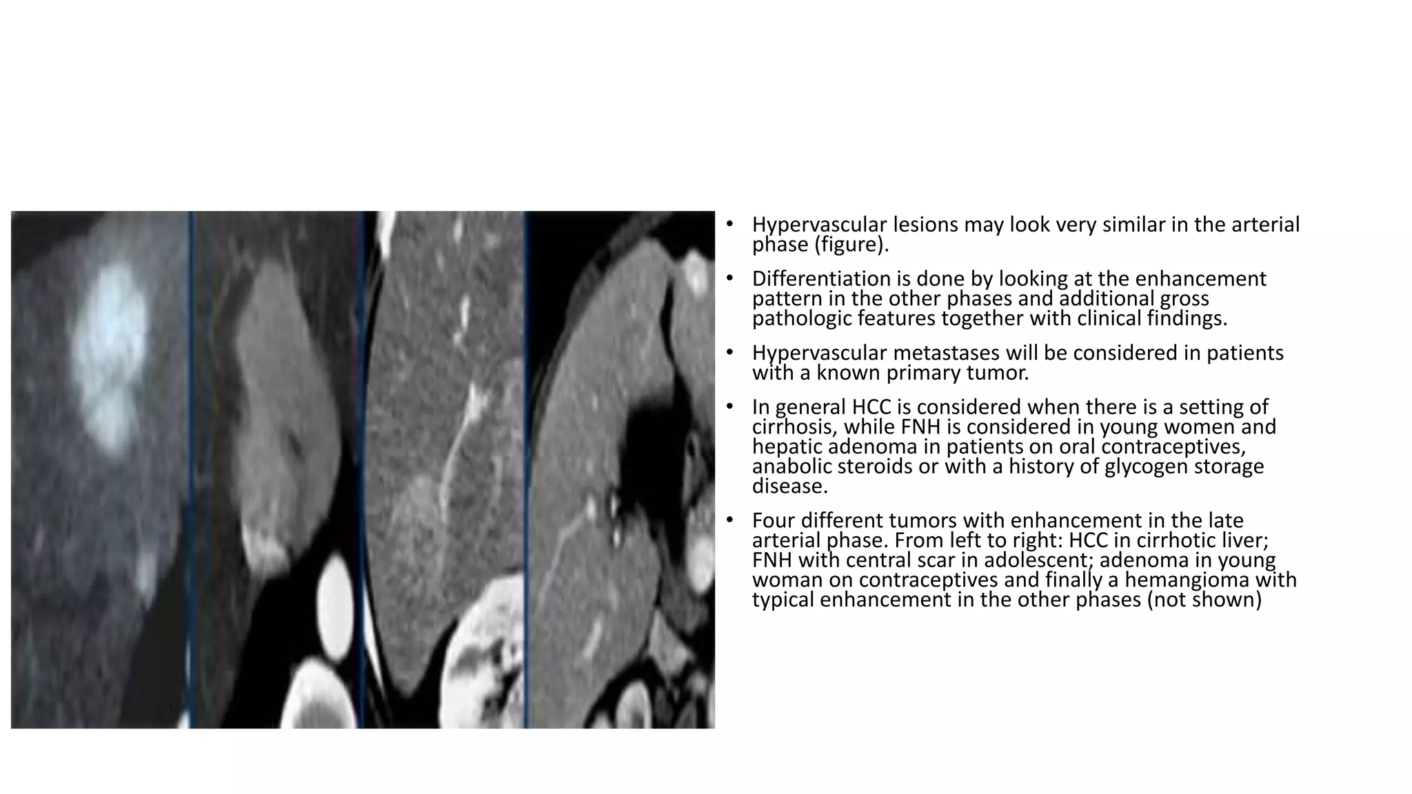 Triphasic CT scan | PPTX