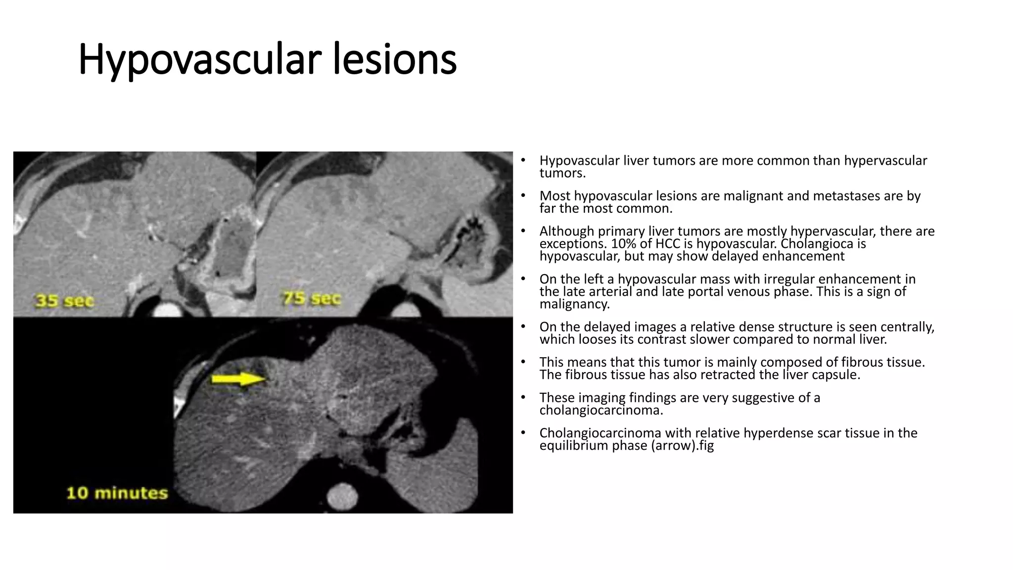 Triphasic CT scan | PPTX