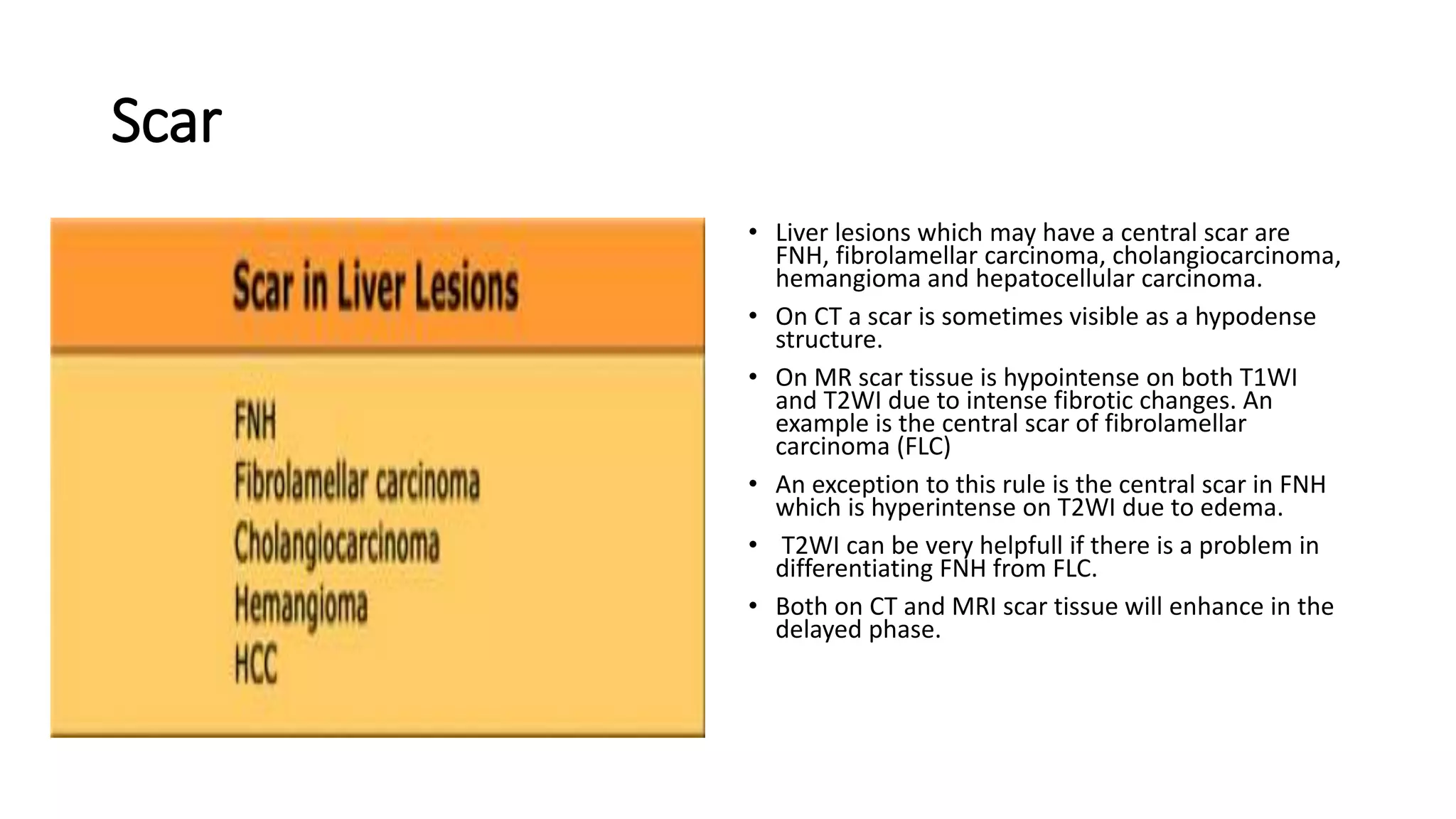 Triphasic CT scan | PPTX