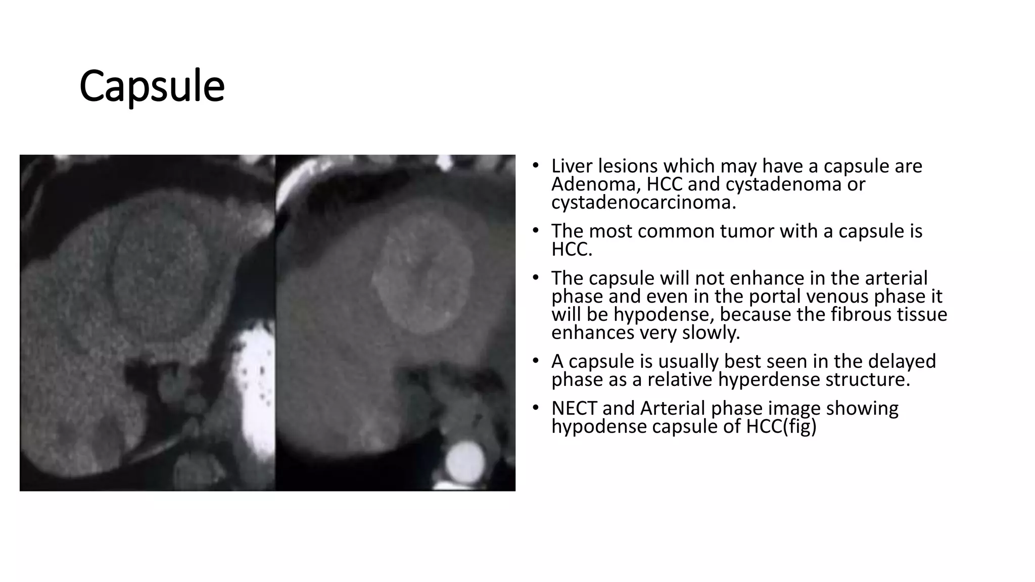 Triphasic CT scan | PPTX