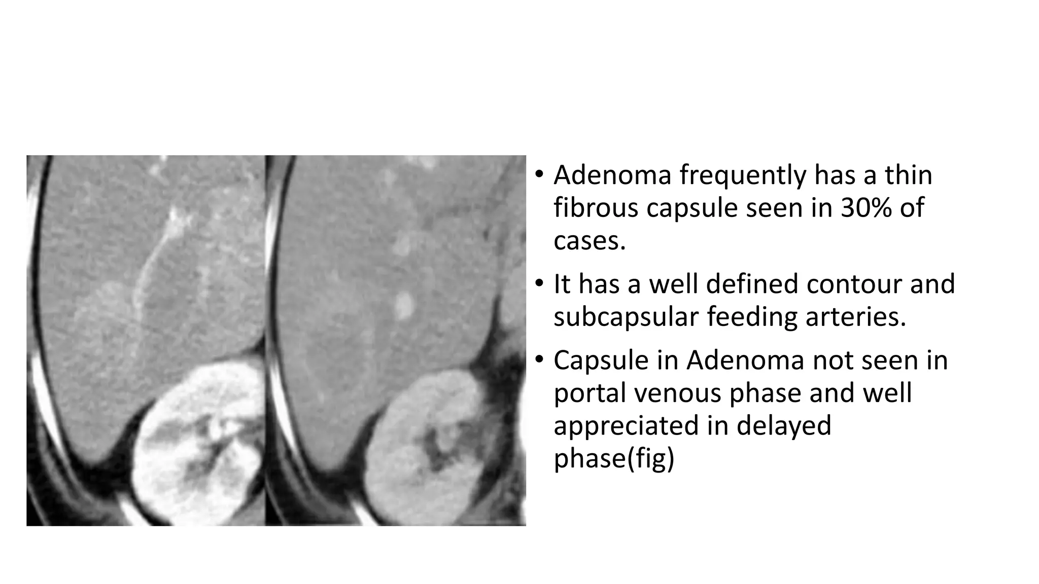 Triphasic CT scan | PPTX