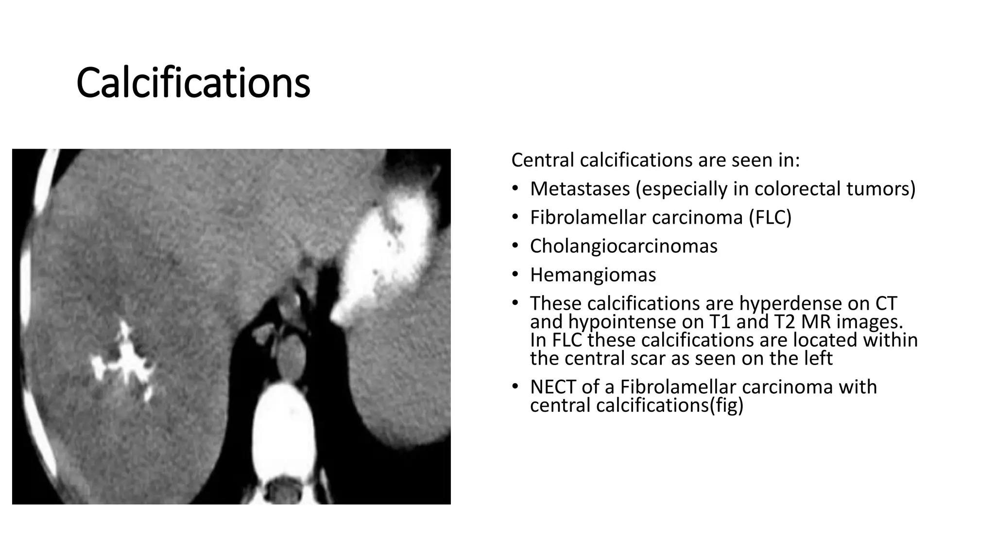 Triphasic CT scan | PPTX
