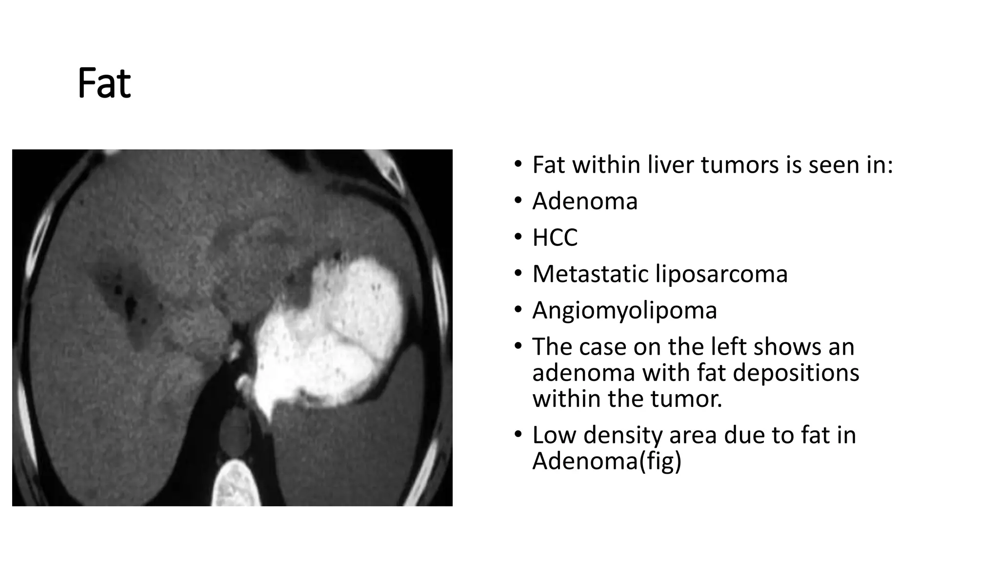 Triphasic CT scan | PPTX