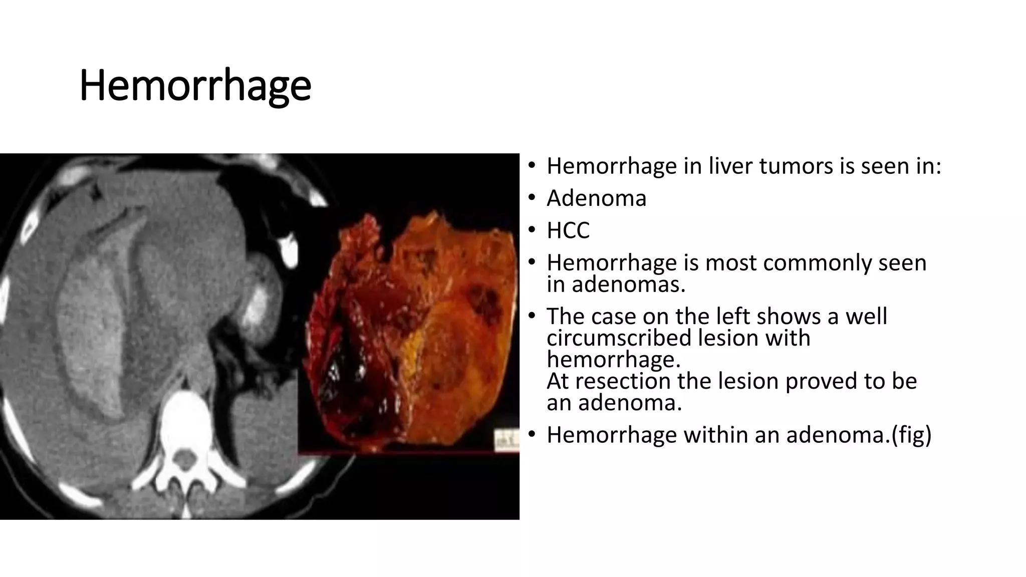 Triphasic CT scan | PPTX