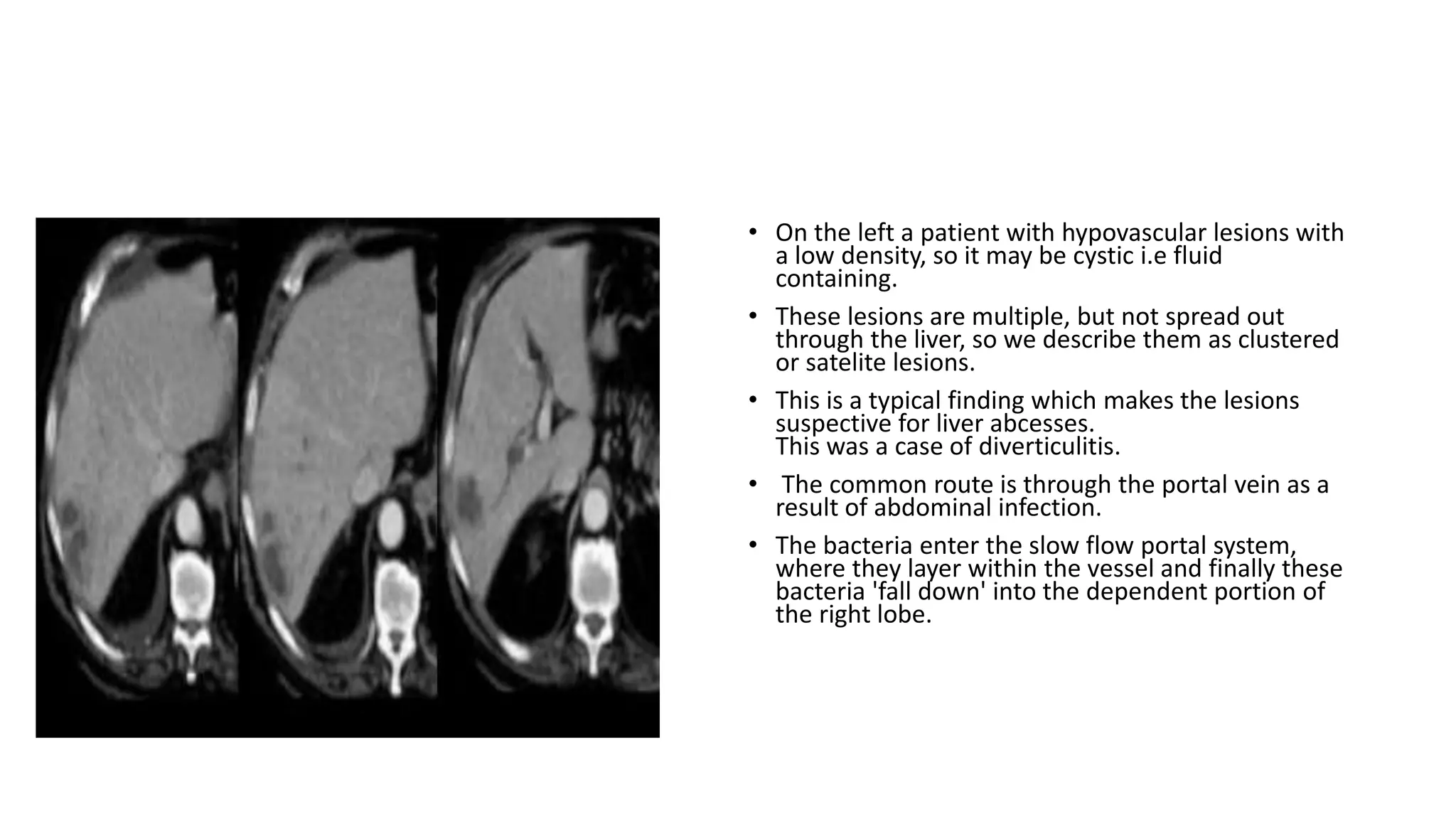 Triphasic CT scan | PPTX