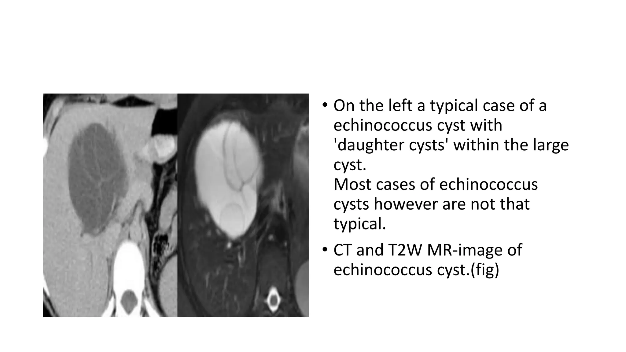 Triphasic CT scan | PPTX