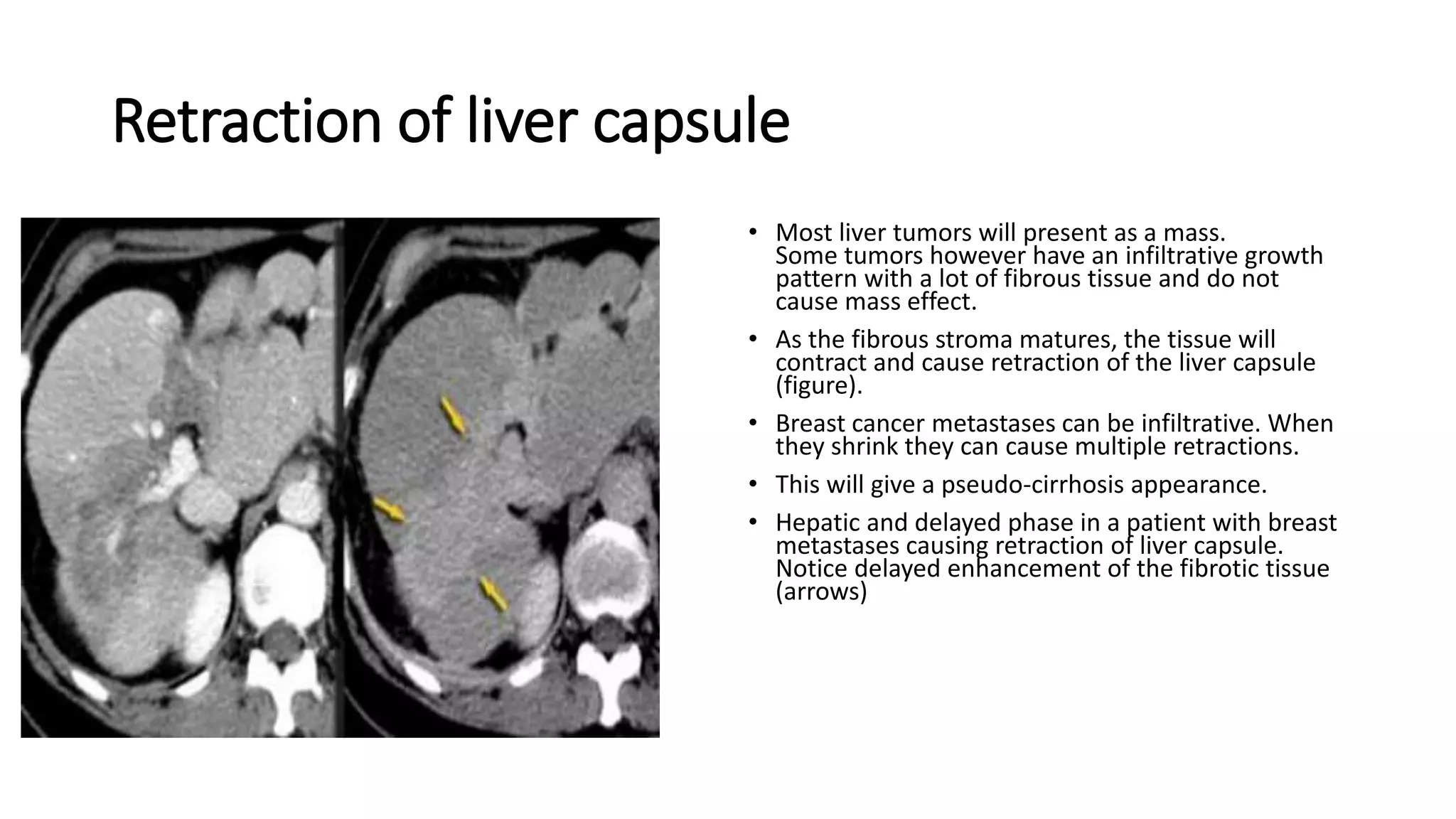 Triphasic CT scan | PPTX