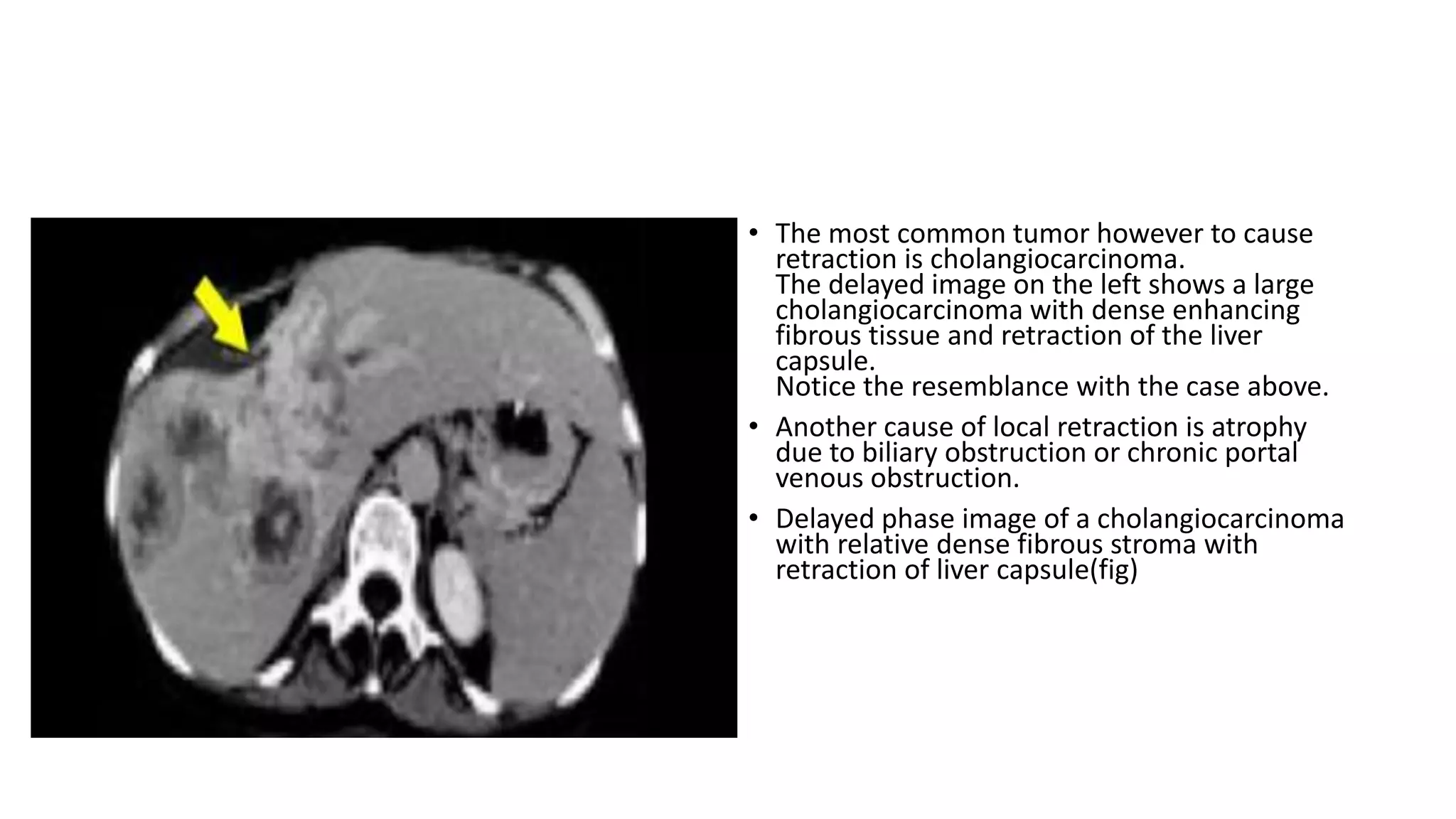 Triphasic CT scan | PPTX
