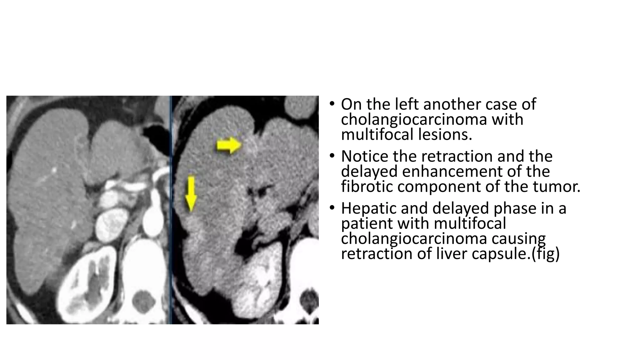 Triphasic CT scan | PPTX