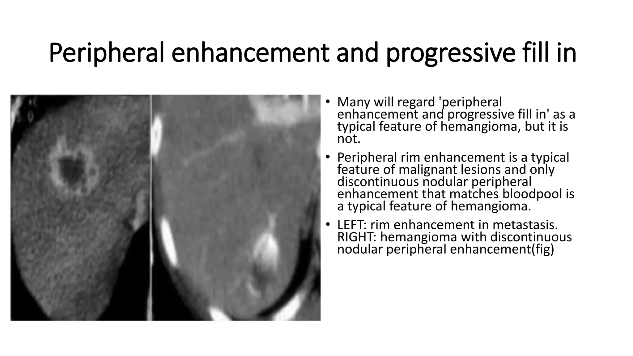 Triphasic CT scan | PPTX