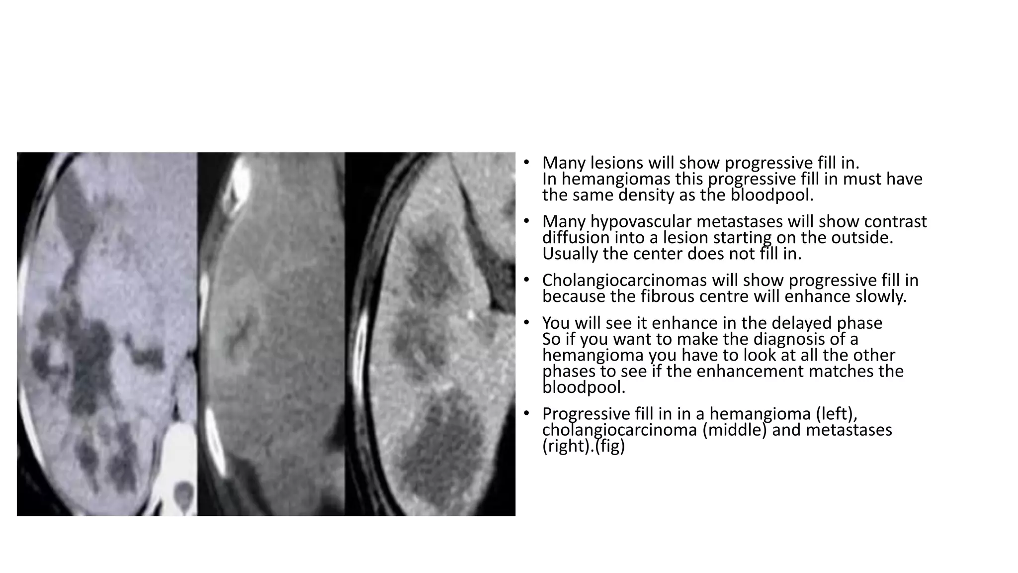 Triphasic CT scan | PPTX