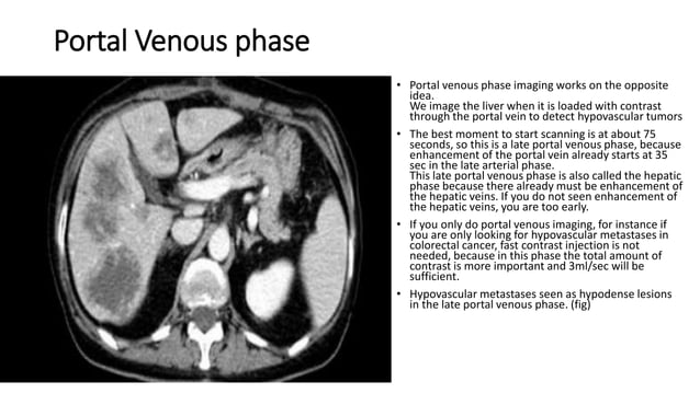 Triphasic CT scan | PPTX