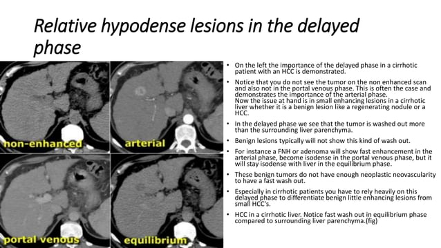 Triphasic CT scan | PPTX