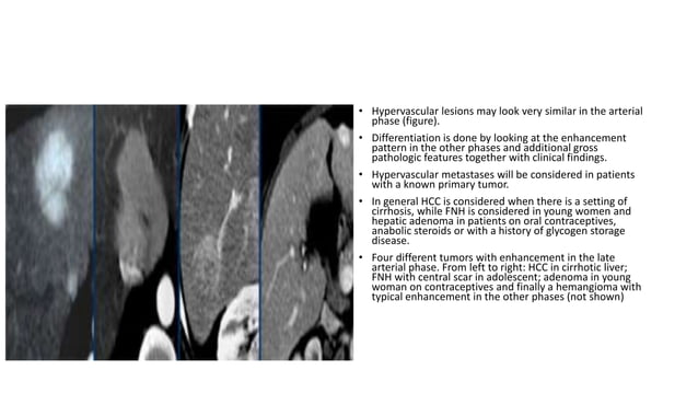 Triphasic CT scan | PPTX