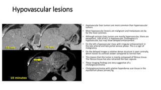 Triphasic CT scan | PPTX