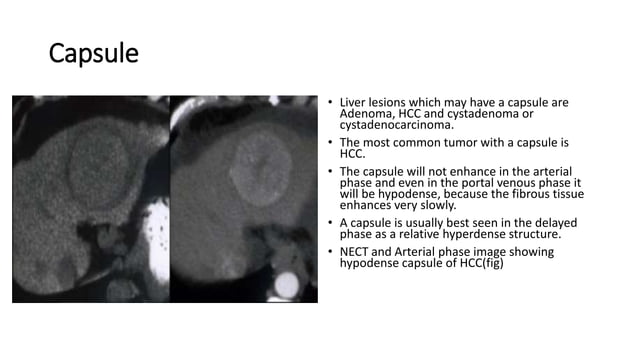 Triphasic CT scan | PPTX