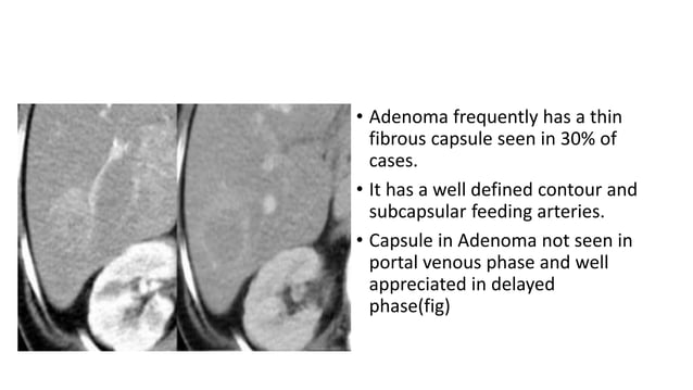 Triphasic CT scan | PPTX