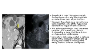 Triphasic CT scan | PPTX