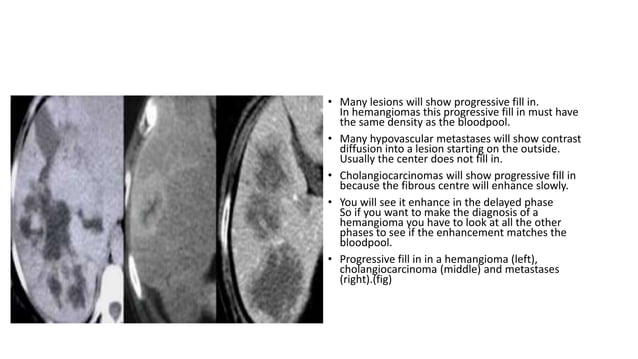 Triphasic CT scan | PPTX