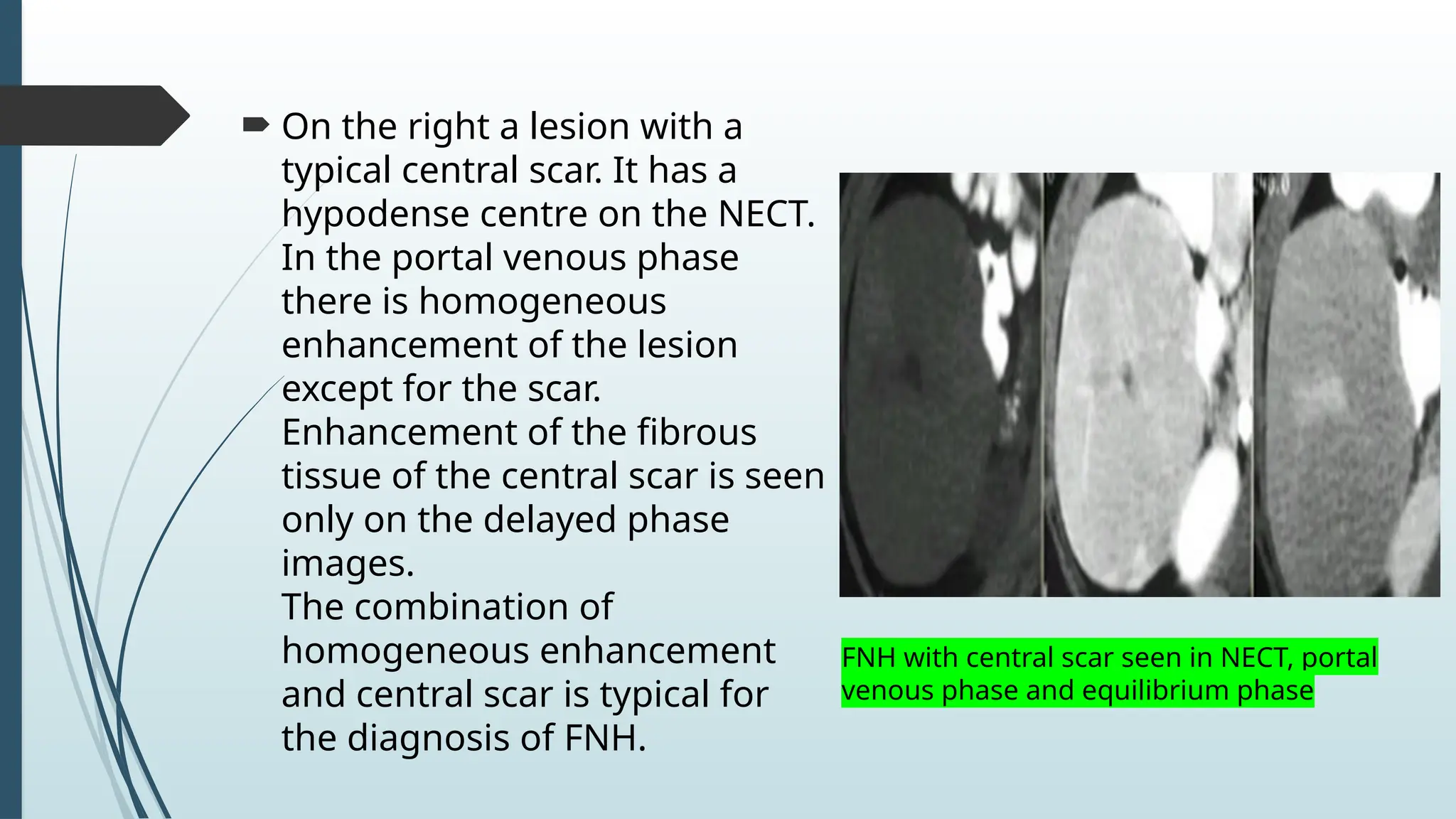 Triphasic CT Scan of Liver radiology.pptx