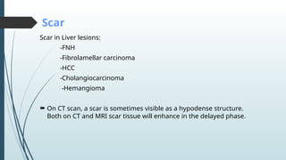 Triphasic CT Scan of Liver radiology.pptx