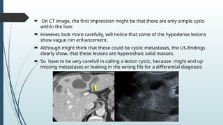 Triphasic CT Scan of Liver radiology.pptx