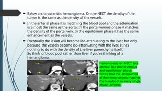 Triphasic CT Scan of Liver radiology.pptx