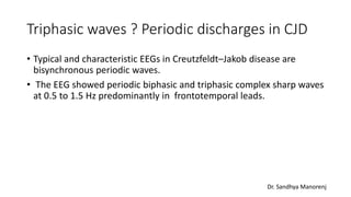 Triphasic waves in EEG | PPTX