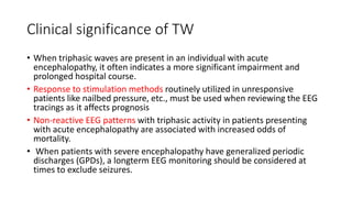 Triphasic waves in EEG | PPTX