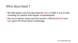 Triphasic waves in EEG | PPTX