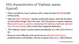 Triphasic waves in EEG | PPTX