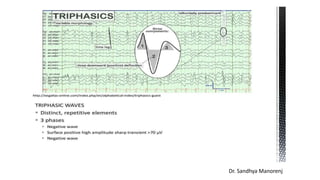 Triphasic waves in EEG | PPTX
