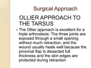 Triple arthrodesis seminar by Dr Chirag Patel | PPTX