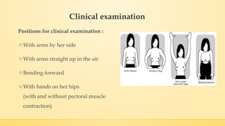 Triple assessment in breast carcinoma final.pptx
