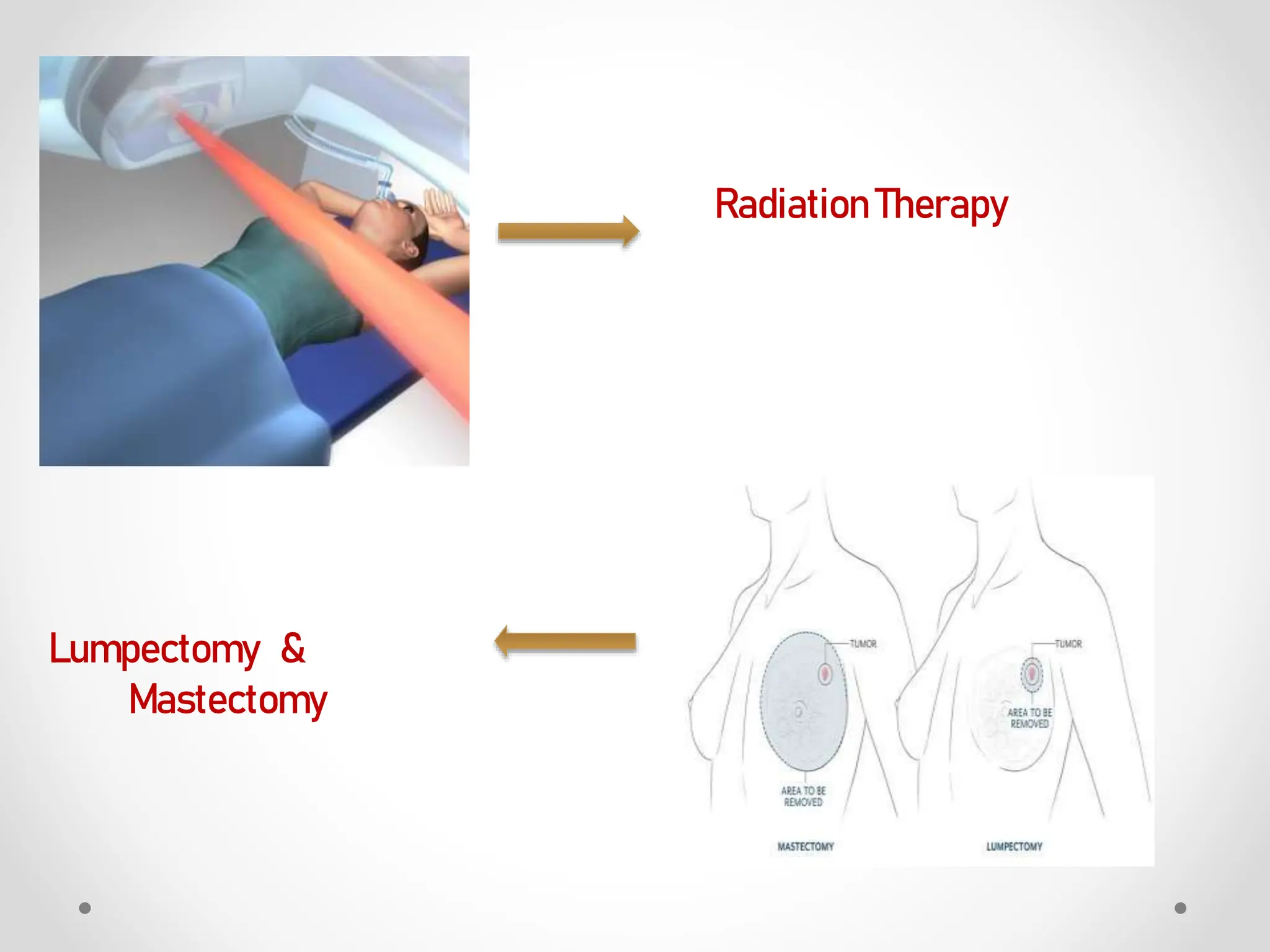 Triple Negative Breast Cancer (TNBC).pptx | Cancer | Diseases and ...