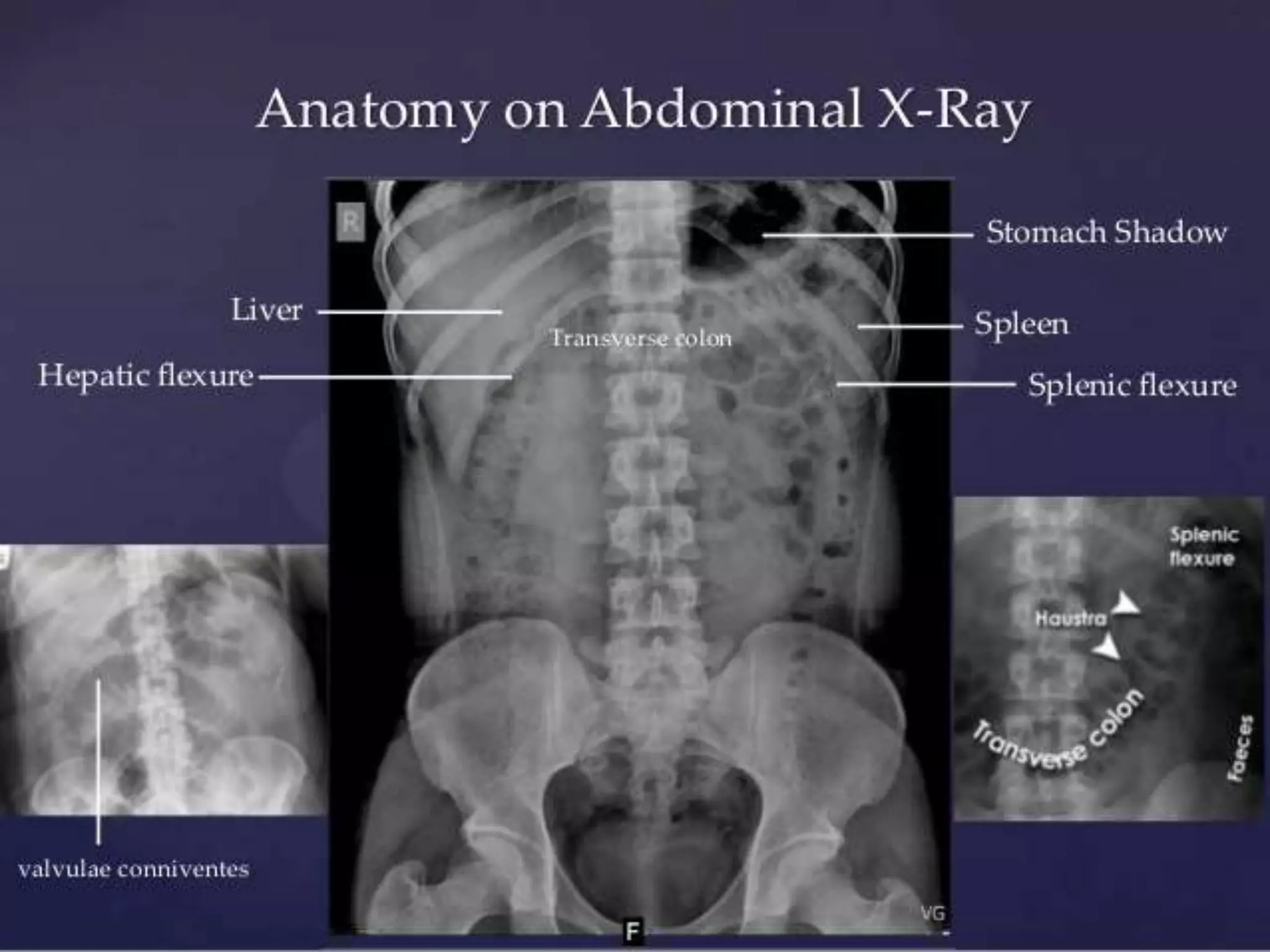 TRIPLE PHASE CT AND ITS TECHNIQUE BY VANI PUSHPA (2).pptx