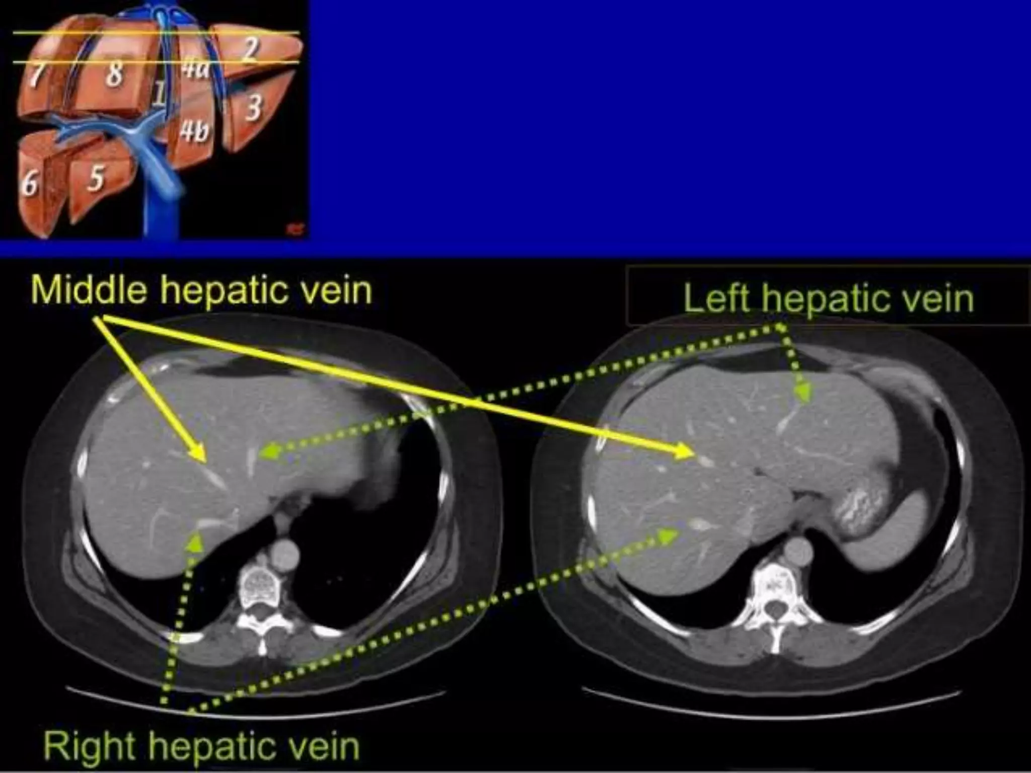 TRIPLE PHASE CT AND ITS TECHNIQUE BY VANI PUSHPA (2).pptx