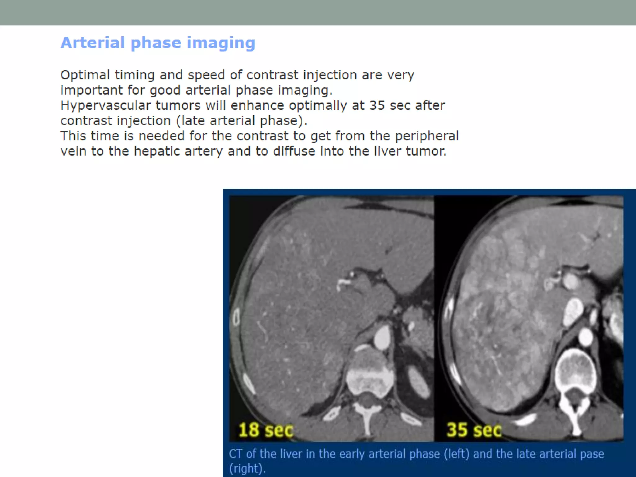 TRIPLE PHASE CT AND ITS TECHNIQUE BY VANI PUSHPA (2).pptx