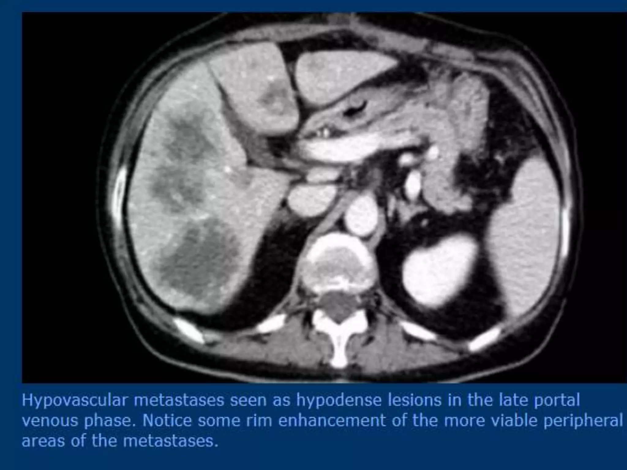 TRIPLE PHASE CT AND ITS TECHNIQUE BY VANI PUSHPA (2).pptx