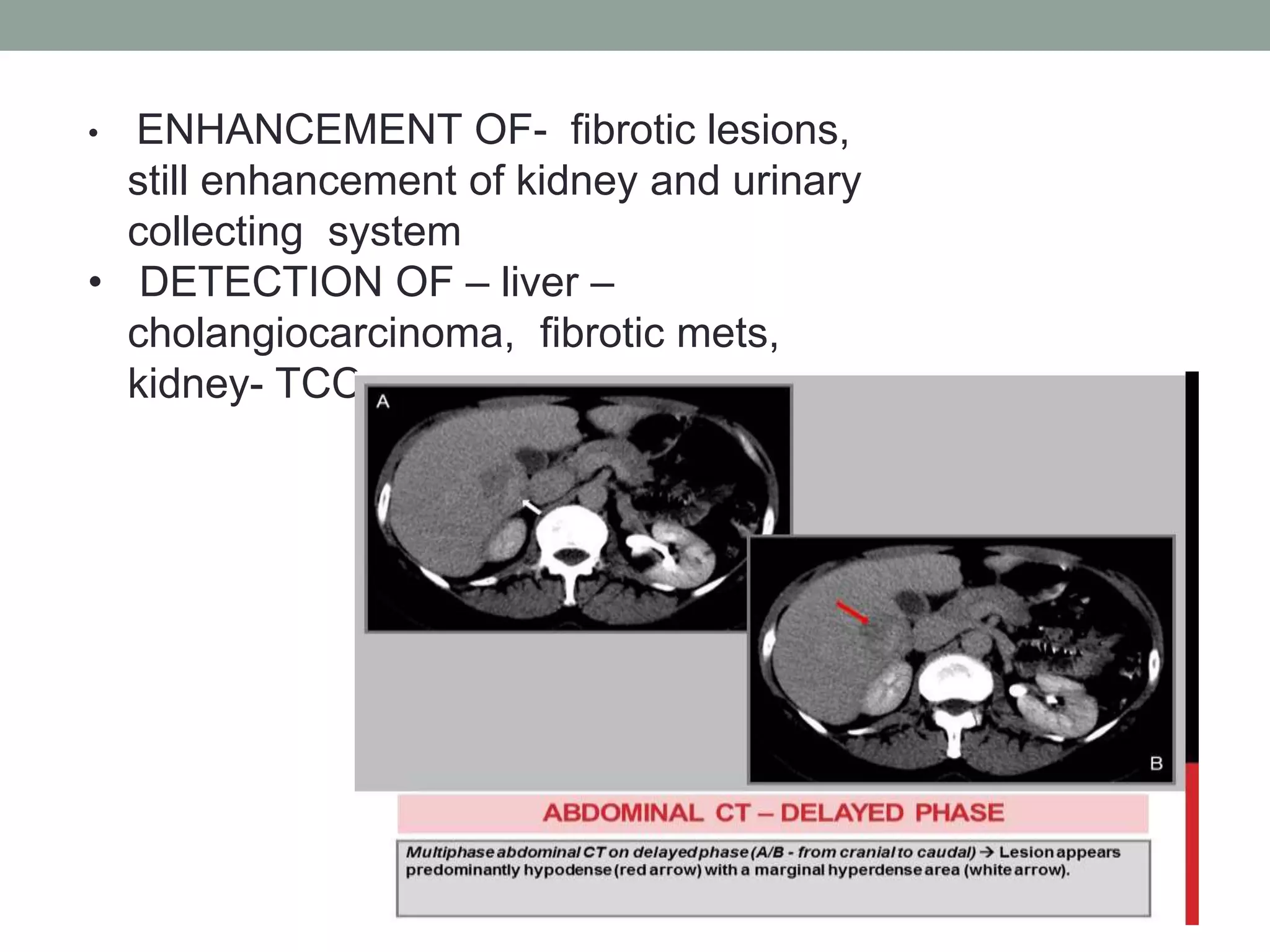 TRIPLE PHASE CT AND ITS TECHNIQUE BY VANI PUSHPA (2).pptx