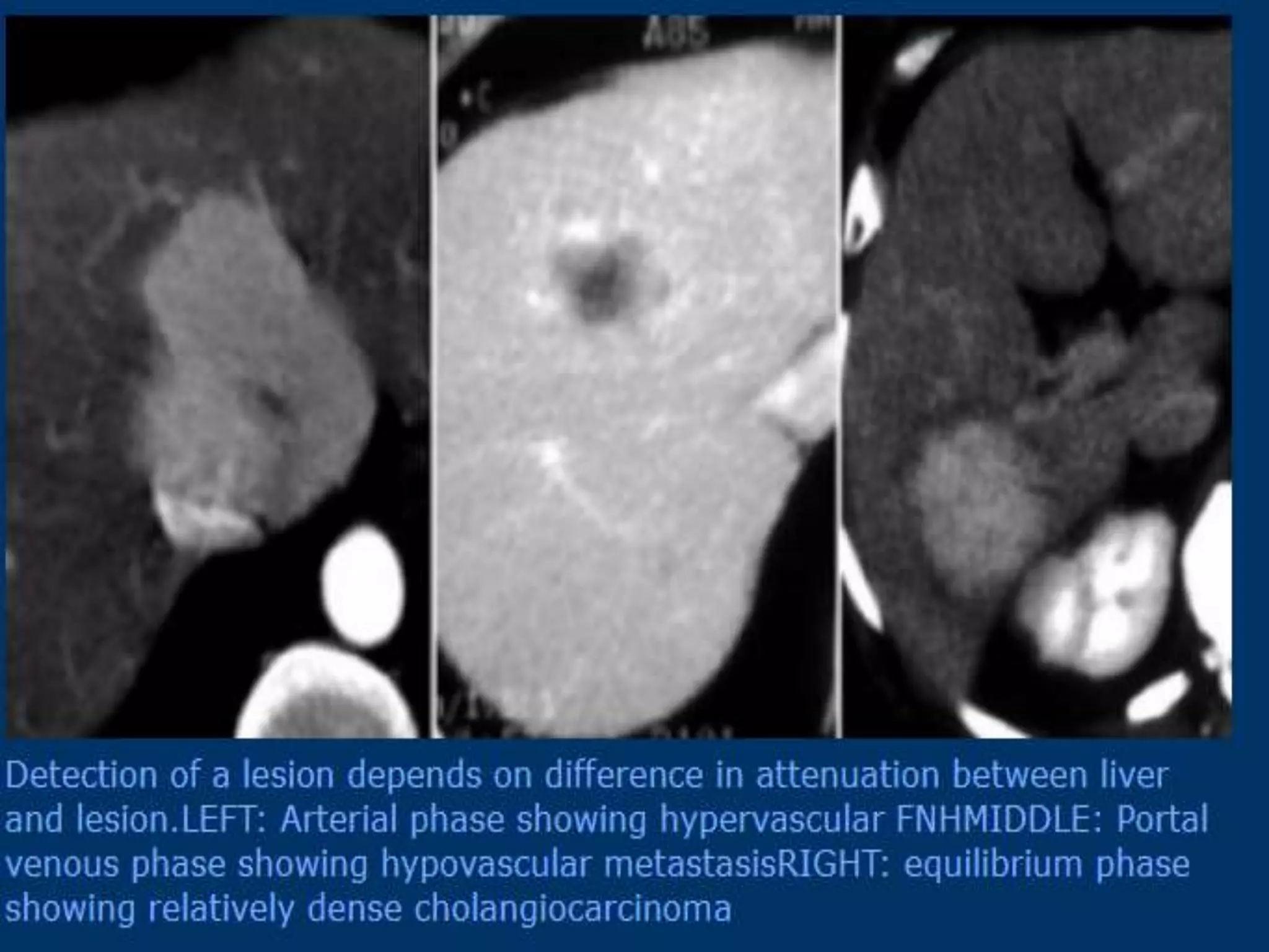 TRIPLE PHASE CT AND ITS TECHNIQUE BY VANI PUSHPA (2).pptx