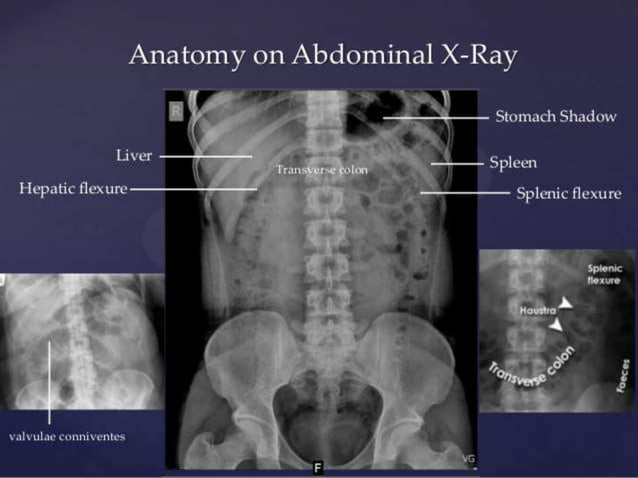 TRIPLE PHASE CT AND ITS TECHNIQUE BY VANI PUSHPA (2).pptx