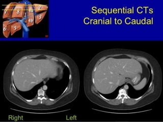 TRIPLE PHASE CT AND ITS TECHNIQUE BY VANI PUSHPA (2).pptx