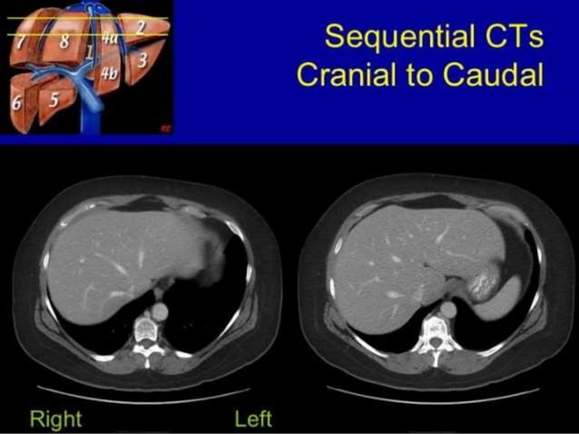 TRIPLE PHASE CT AND ITS TECHNIQUE BY VANI PUSHPA (2).pptx