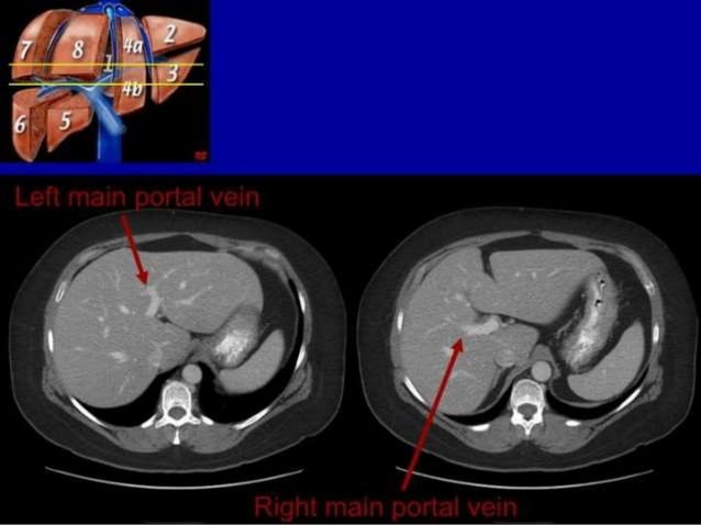 TRIPLE PHASE CT AND ITS TECHNIQUE BY VANI PUSHPA (2).pptx