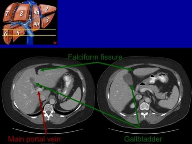 TRIPLE PHASE CT AND ITS TECHNIQUE BY VANI PUSHPA (2).pptx