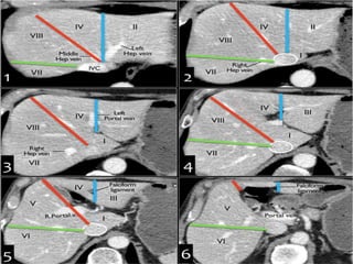 TRIPLE PHASE CT AND ITS TECHNIQUE BY VANI PUSHPA (2).pptx