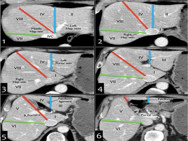 TRIPLE PHASE CT AND ITS TECHNIQUE BY VANI PUSHPA (2).pptx